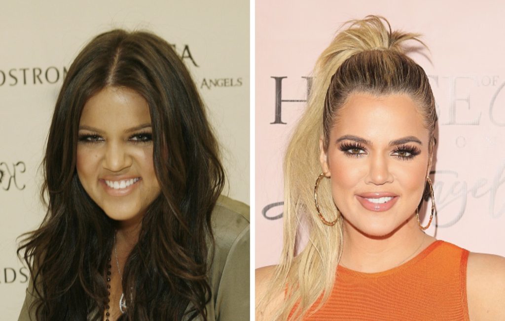 Khloé Kardashian Reveals She’s Only Gotten One Nose Job • Hollywood ...
