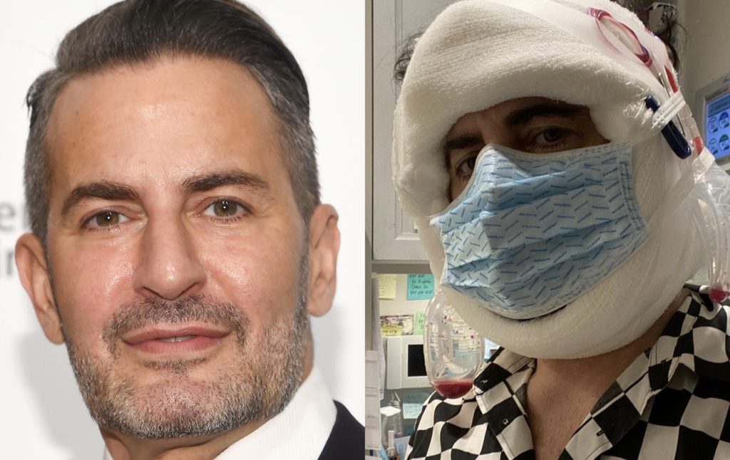 Fashion Designer Marc Jacobs Reveals He Got A Facelift • Hollywood Unlocked