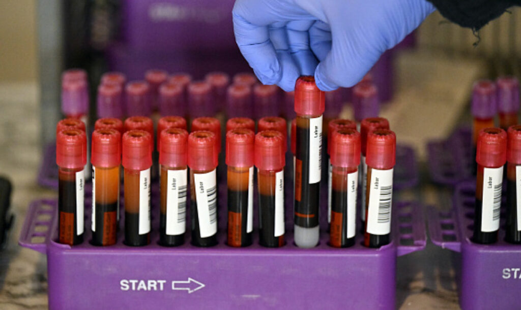FDA Updates Blood Donation Policy To Include Gay, Bisexual Men ...