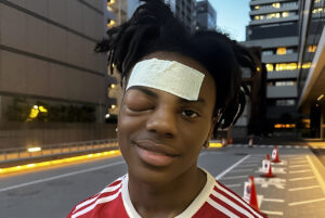 iShowSpeed Rushed To Hospital With Cluster Headaches, Treated For ...