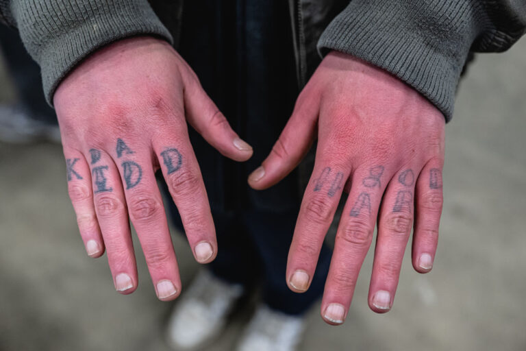 Frozen Fingers Saved! FDA Approves First Drug to Battle Severe ...