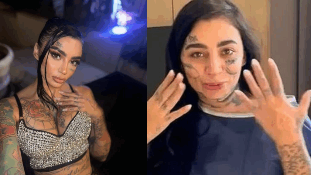 Brazilian Influencer Dies After Plastic Surgery in Turkey, Husband Says ...