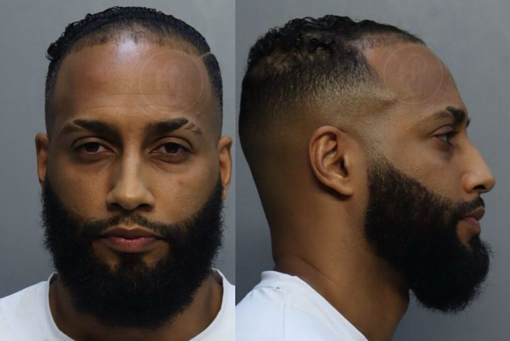 'Love & Hip-Hop: Miami' Cast Member Allan Mueses Charged With 4 Counts ...